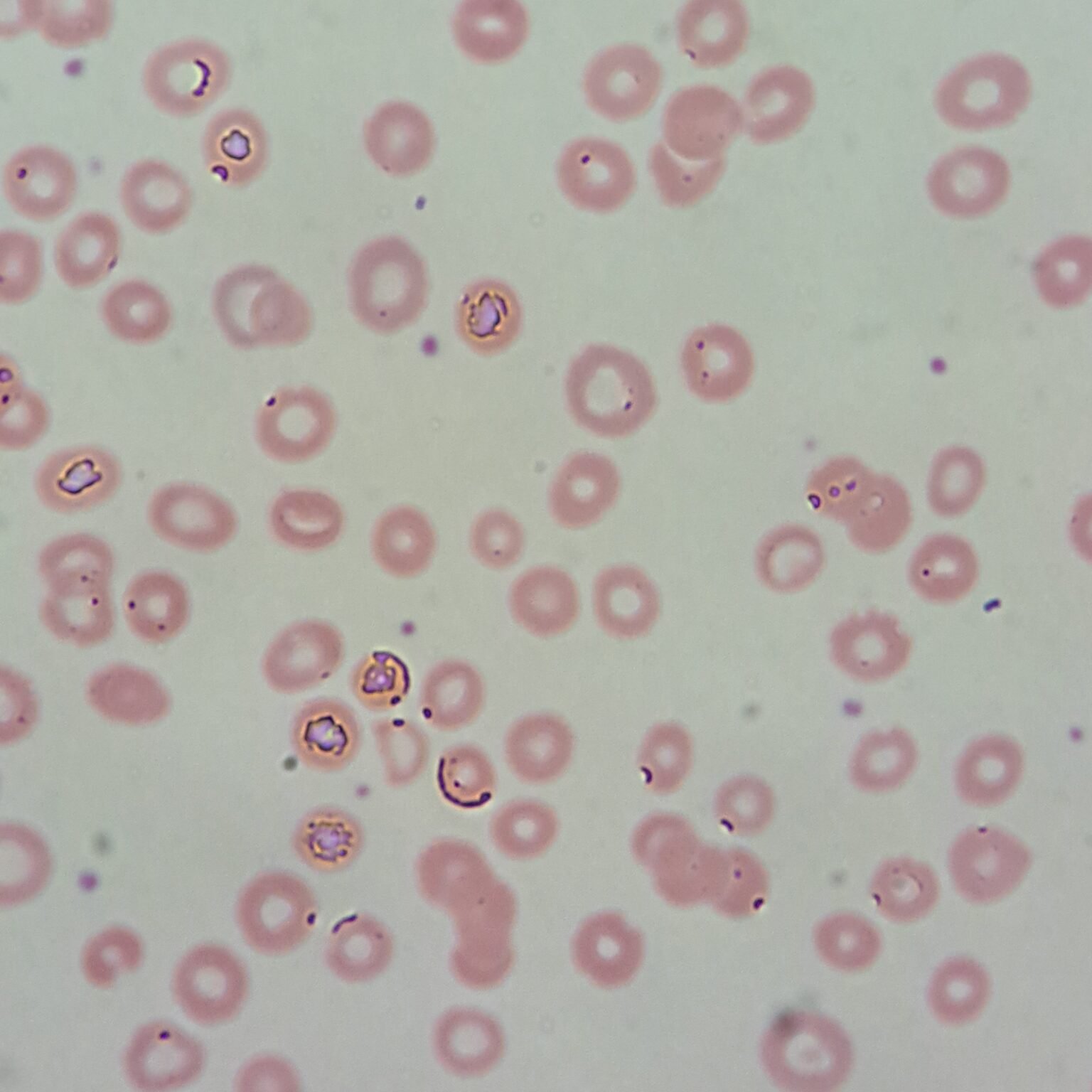 Cabot Rings - MedLabBuddy