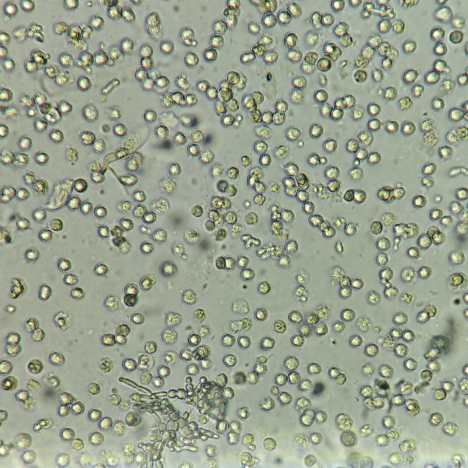 Yeast: Budding & Hyphae - MedLabBuddy