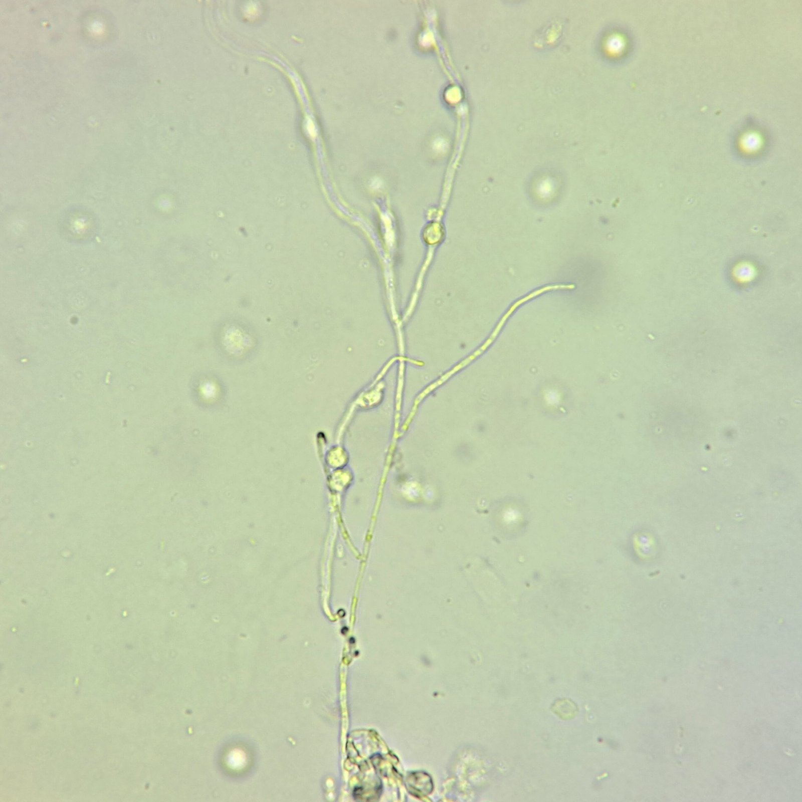 Candida In Urine Under Microscope