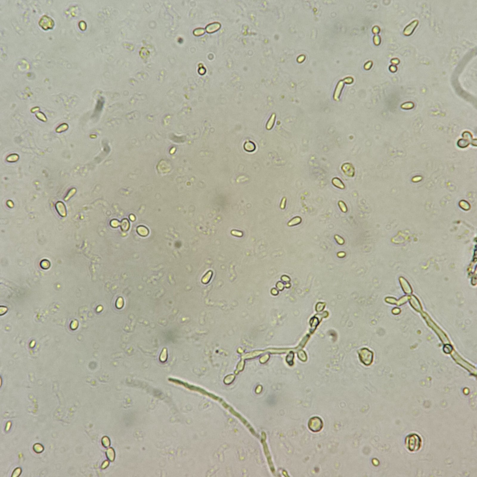 Yeast: Budding & Hyphae - MedLabBuddy