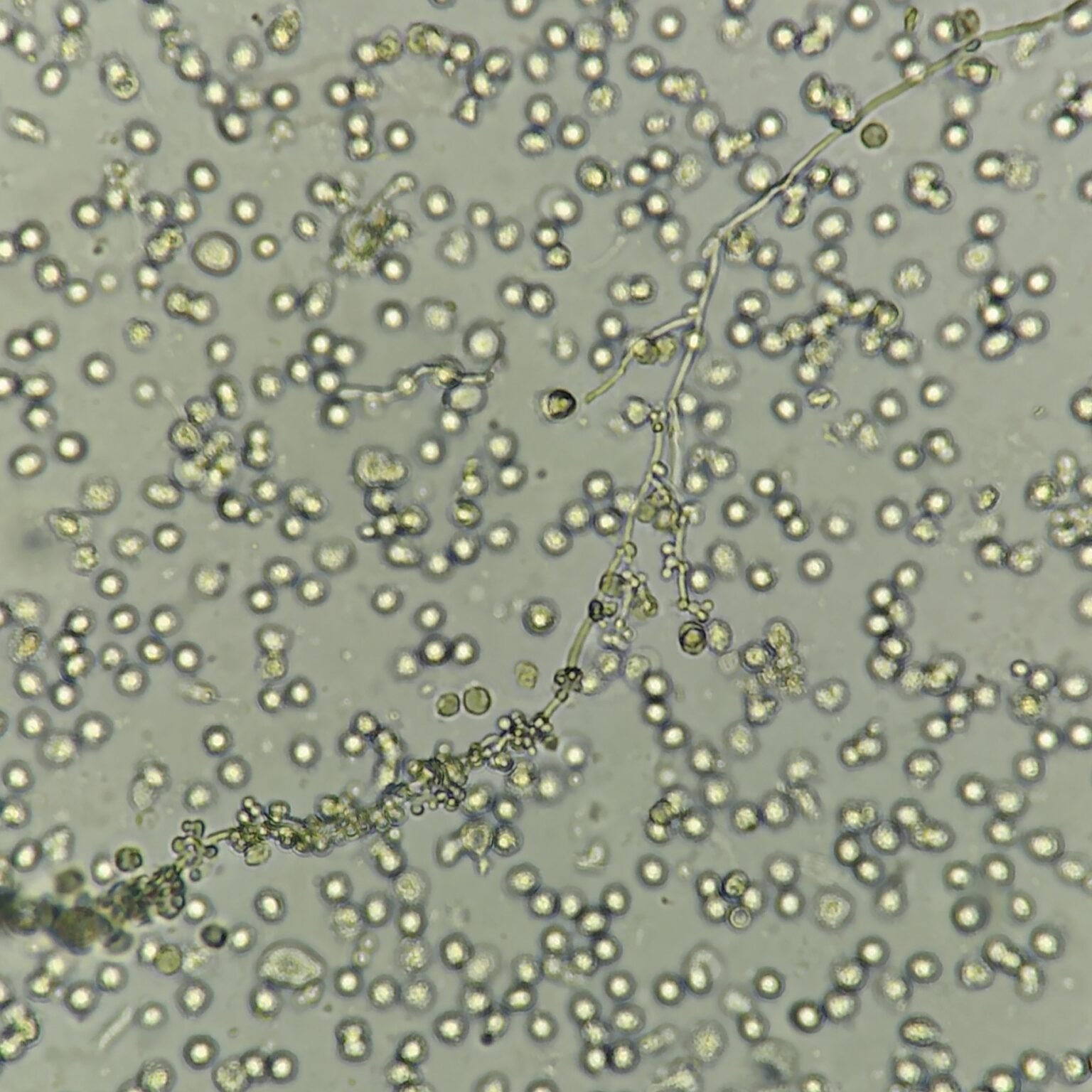 Yeast: Budding & Hyphae - MedLabBuddy
